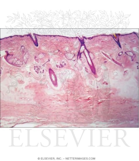 Photomicrograph Of Thin Skin Labeled