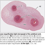 Low Magnification Light Micrograph Of The Umbilical Cord