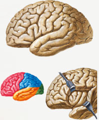 Welcome To Netter Images