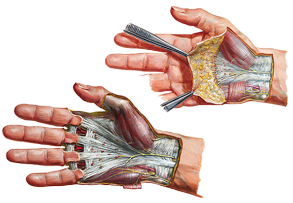 Welcome To Netter Images