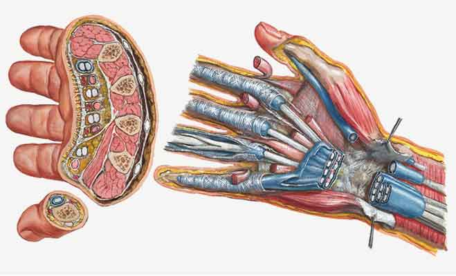 Welcome To Netter Images