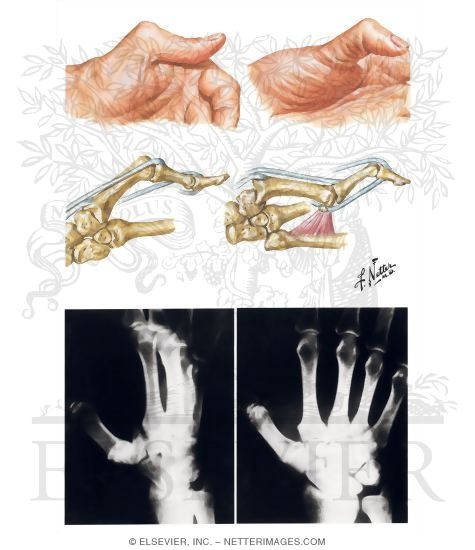 Welcome To Netter Images