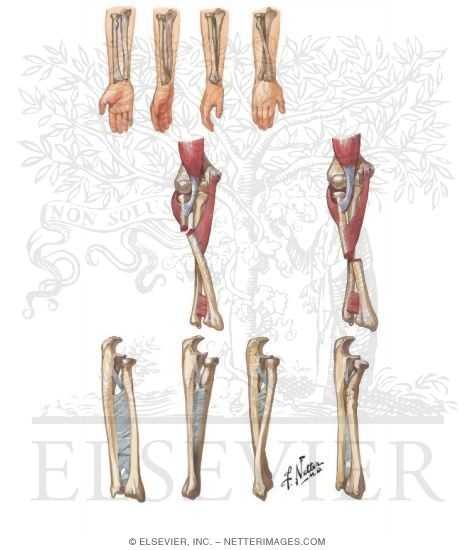 Biomechanic Considerations in Fracture of Forearm Bones