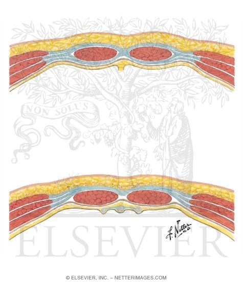 rectus sheath - meddic