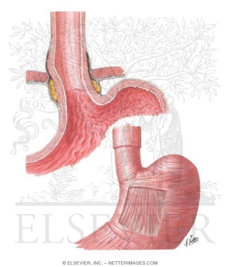 Gastroesophageal Junction Slide Labeled