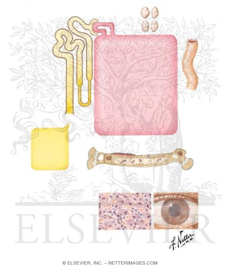 Vitamin D-Resistant Rickets and Osteomalacia Due to Proximal and Distal ...