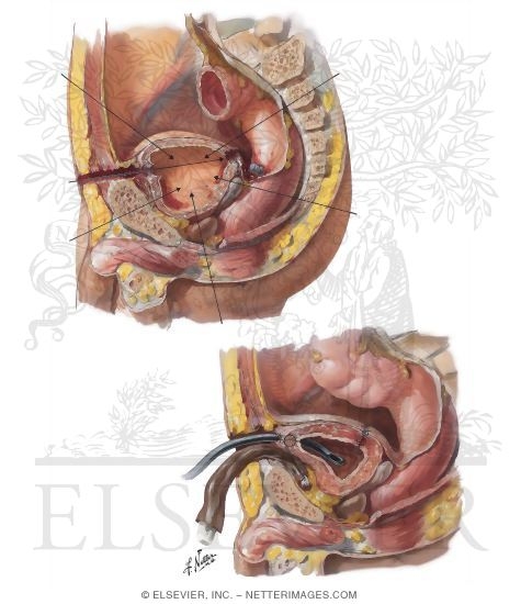 human bladder volume