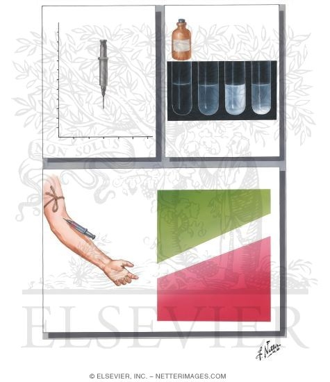 Commonly Used Tests for Diagnosis of Abnormalities in Calcium Metabolism