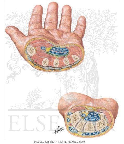 Section Through Metacarpal Bones - Section Through Distal Carpal Bones