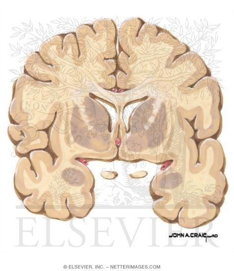 Coronal Forebrain Sections (Level 2 of 10)