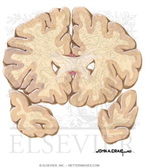 Coronal Forebrain Sections (Level 1 of 10)