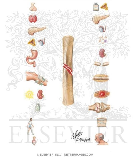 Factors That Promote or Delay Bone Healing