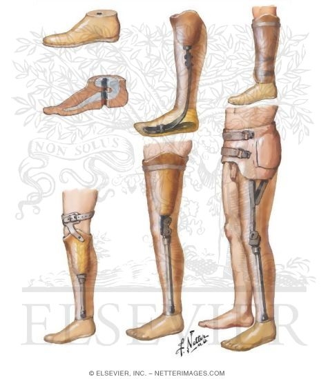Prostheses For Lower Limb
