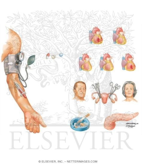 Risk Assessment in Primary Prevention