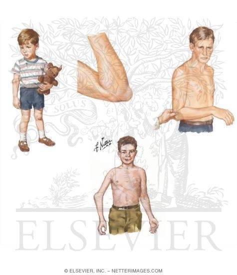 Physical Examination of the Elbow