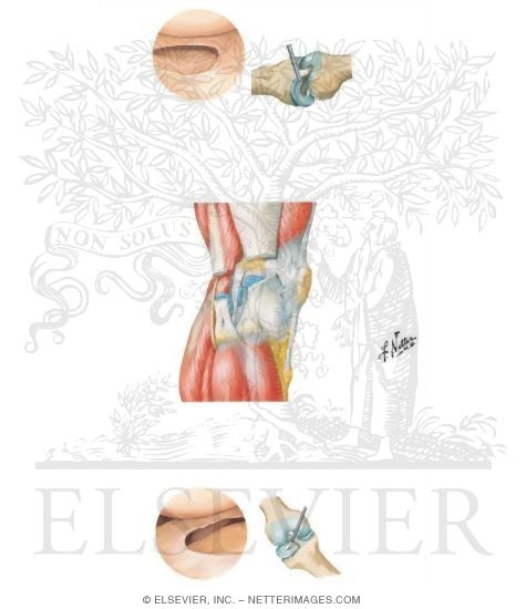 Basic Arthroscopic Techniques and Normal Anatomy Knee Joints