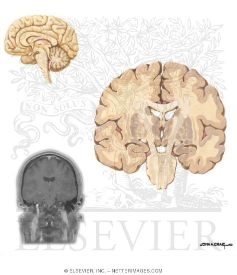 Coronal Sections Through the Forebrain: Mammillary Bodies