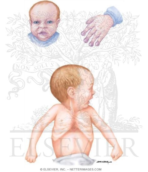 Congenital Heart Defect Concepts