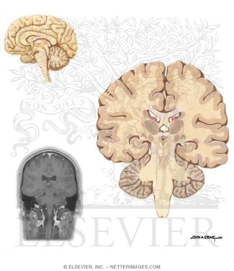 Coronal Sections Through the Forebrain: Geniculate Nuclei