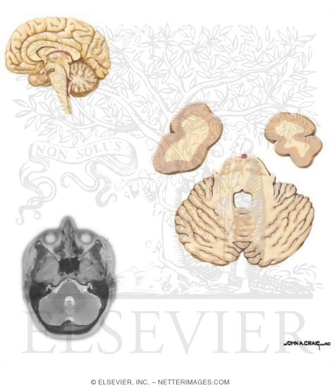 Horizontal Sections Through the Forebrain: Mid Pons