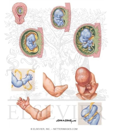 Welcome To Netter Images