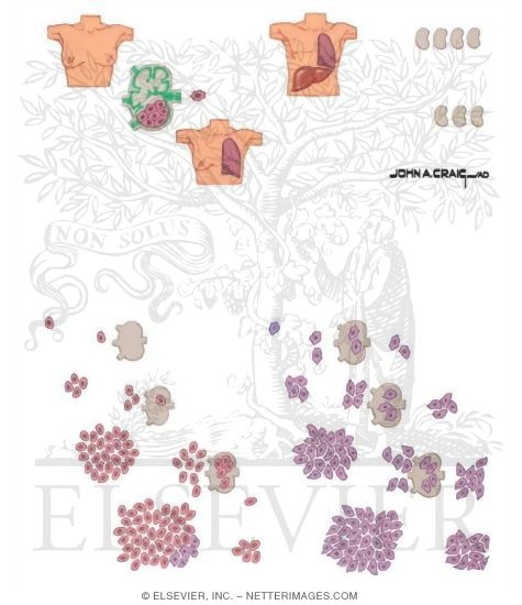 Pathways of Tumor Dissemination