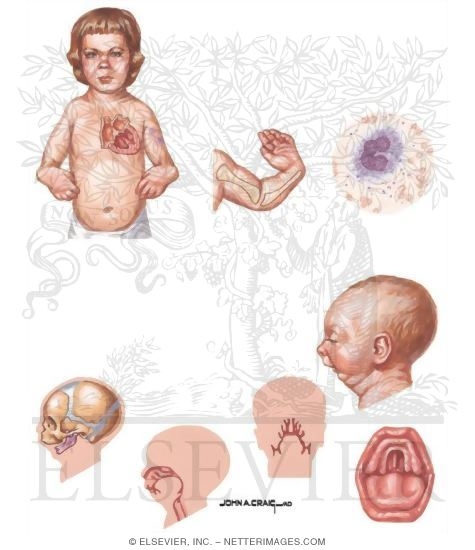 Patterns of Multiple Anomalies
