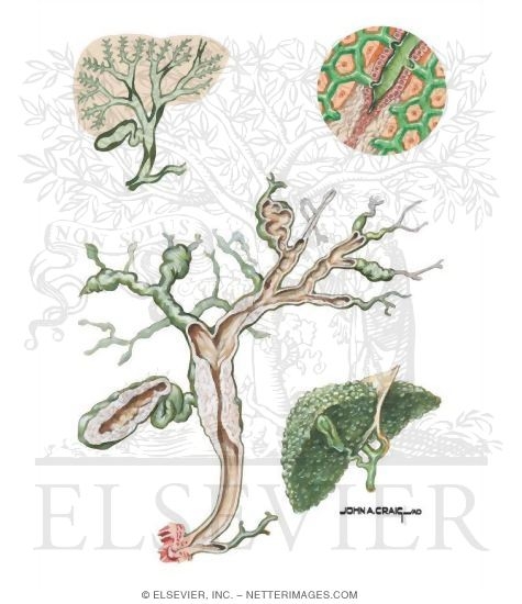 Diseases of the Biliary Tract