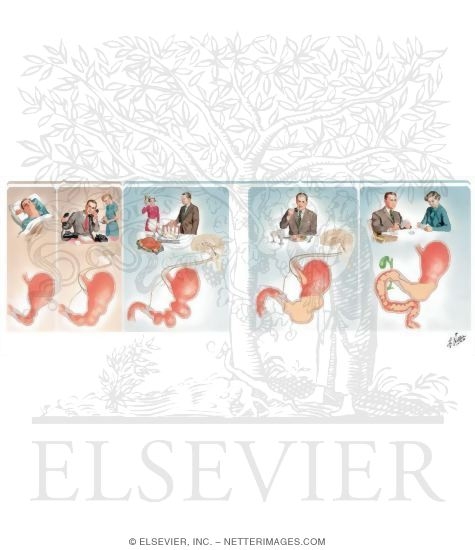 Mechanisms of Gastric Secretion