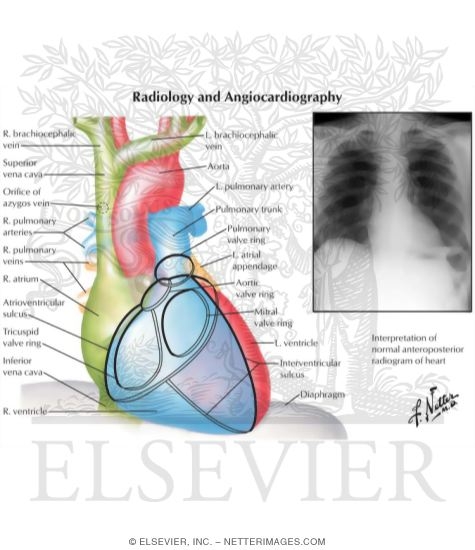 Radiology and Angiocardiography