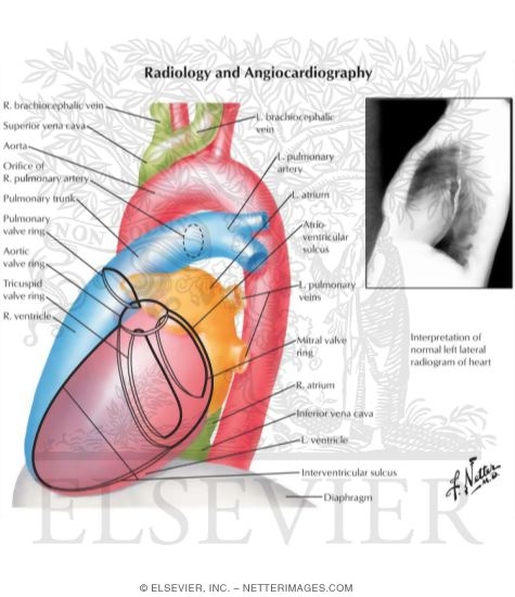 aortic valve anatomy radiology