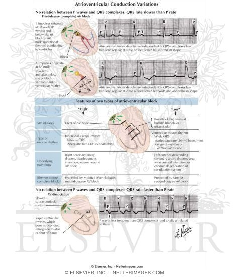 Atrioventricular Conduction Variations