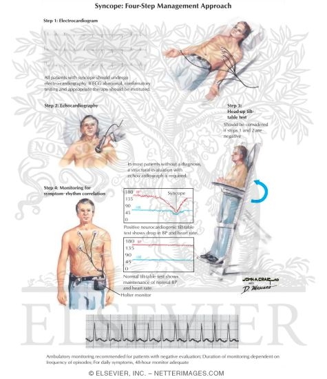 Syncope: Four-Step Management Approach