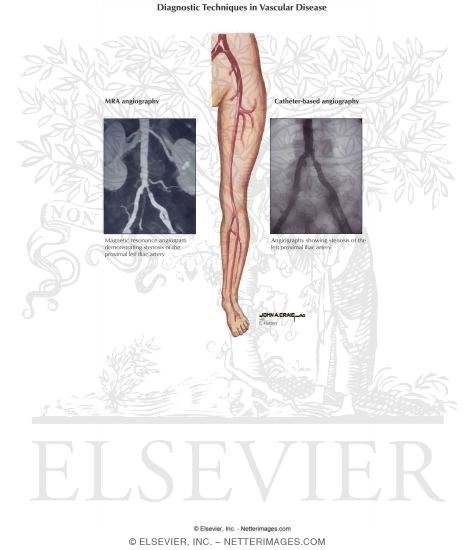 Diagnostic Techniques in Vascular Disease