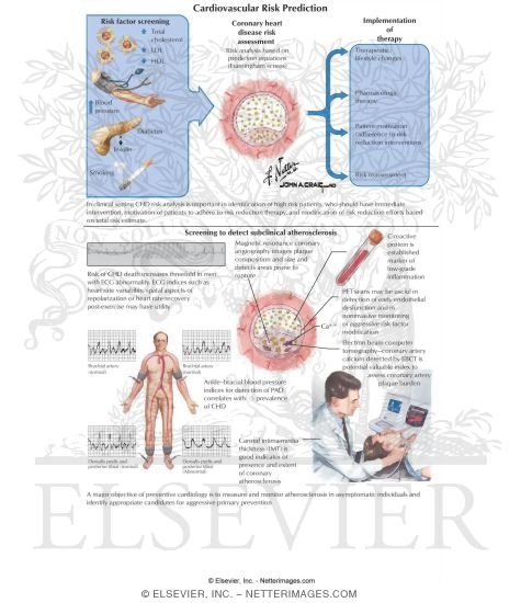 Cardiovascular Risk Prediction