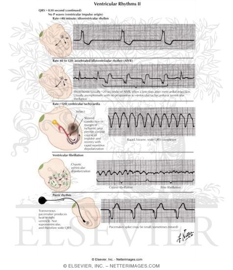 Ventricular Rhythms