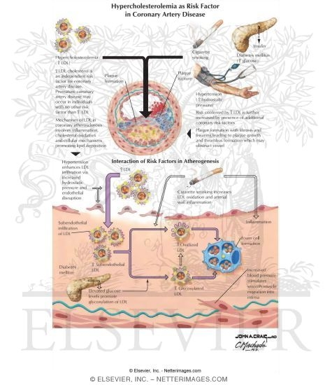 Hypercholesterolemia As Risk Factor In Coronary Artery Disease