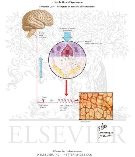 Irritable Bowel Syndrome - Enteric Sensory Neurons