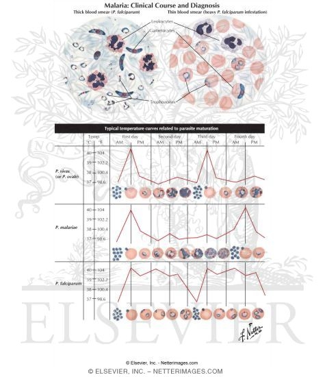 Malaria: Clinical Course and Diagnosis