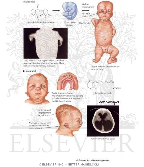 Drug-Induced Embryopathies