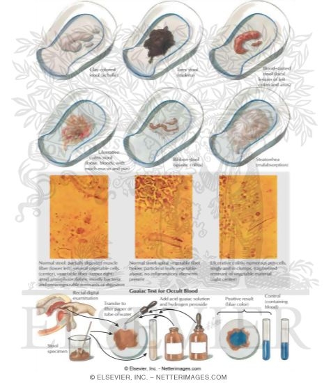 Stool Examination