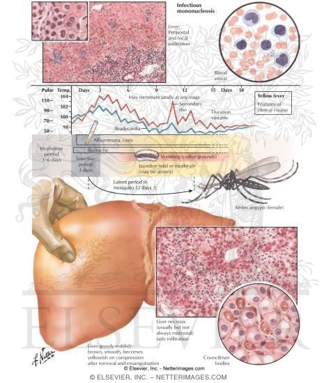 Infectious Mononucleosis, Yellow Fever