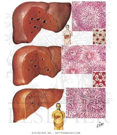 The Liver In Heart Failure: Cardiac Liver and Shock