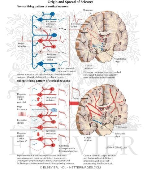 Origin and Spread of Seizures
