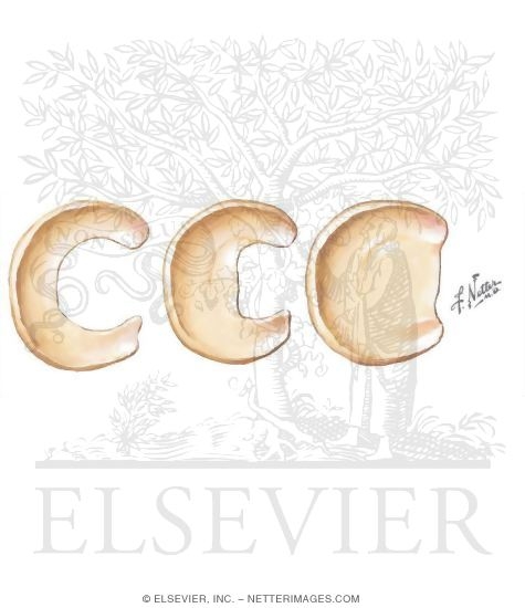 Discoid Meniscus Variations