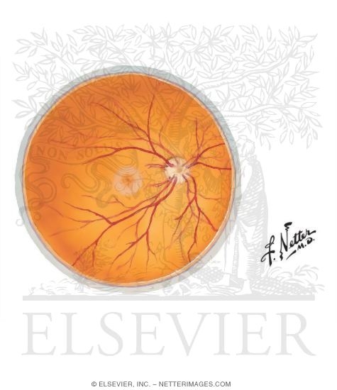 Ophthalmoscopic View of the Right Retina