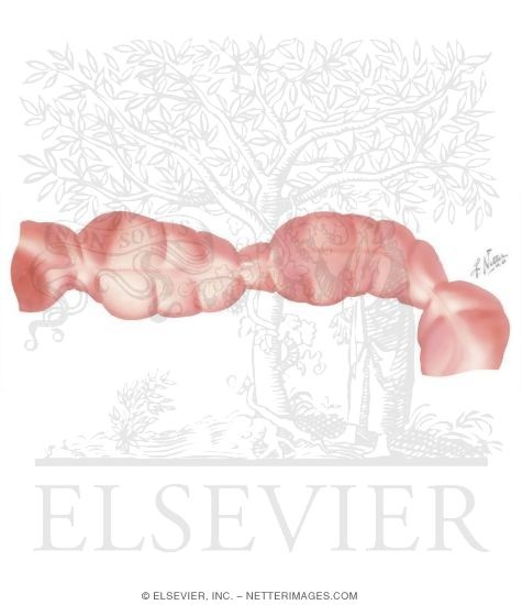 Excessive Contractions In the Colon