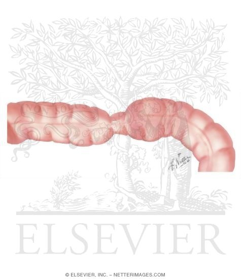 Slowed Contraction of the Colon