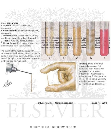 synovial fluid coloring pages