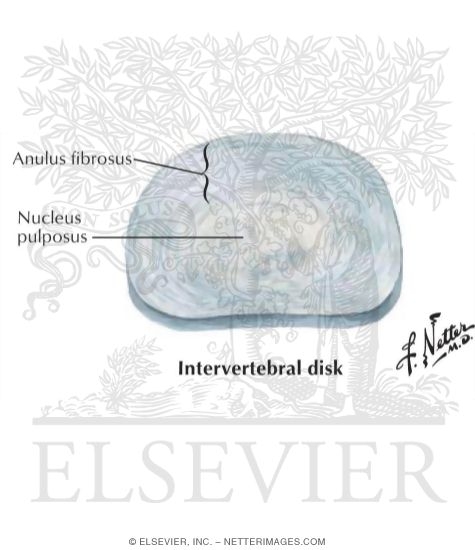 Lumbar Intervertebral Disk